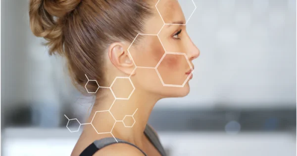 Какво трябва да знаем за възрастовите петна по лицето?