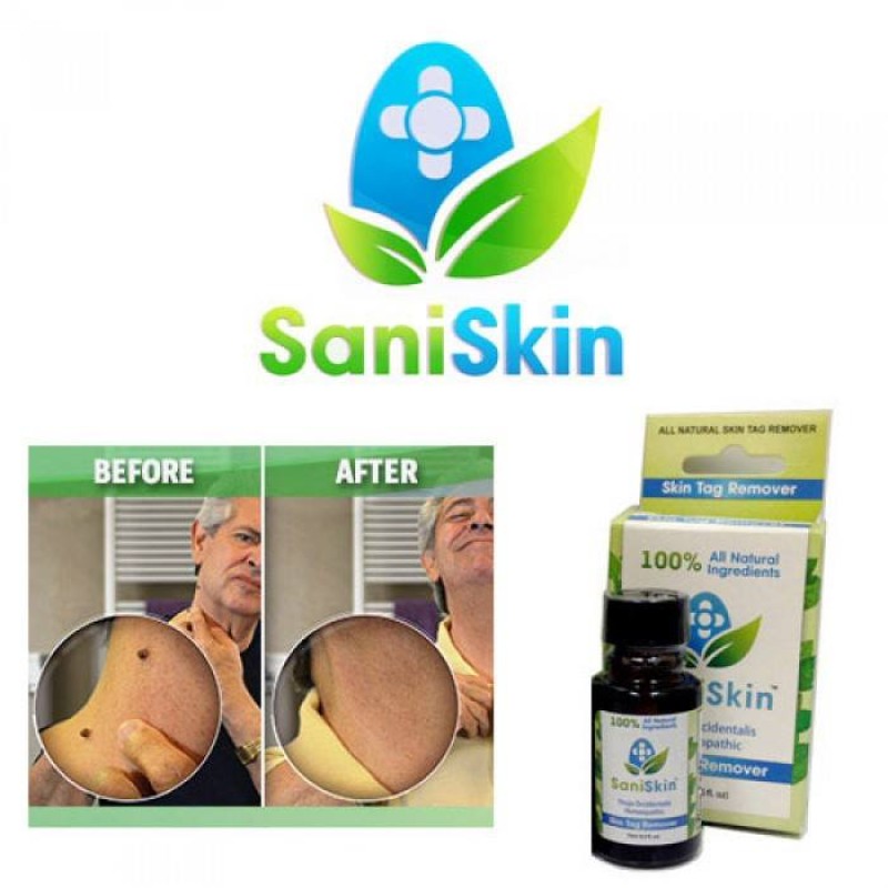 Sani Skin за папиломи и брадавици Топ Цена