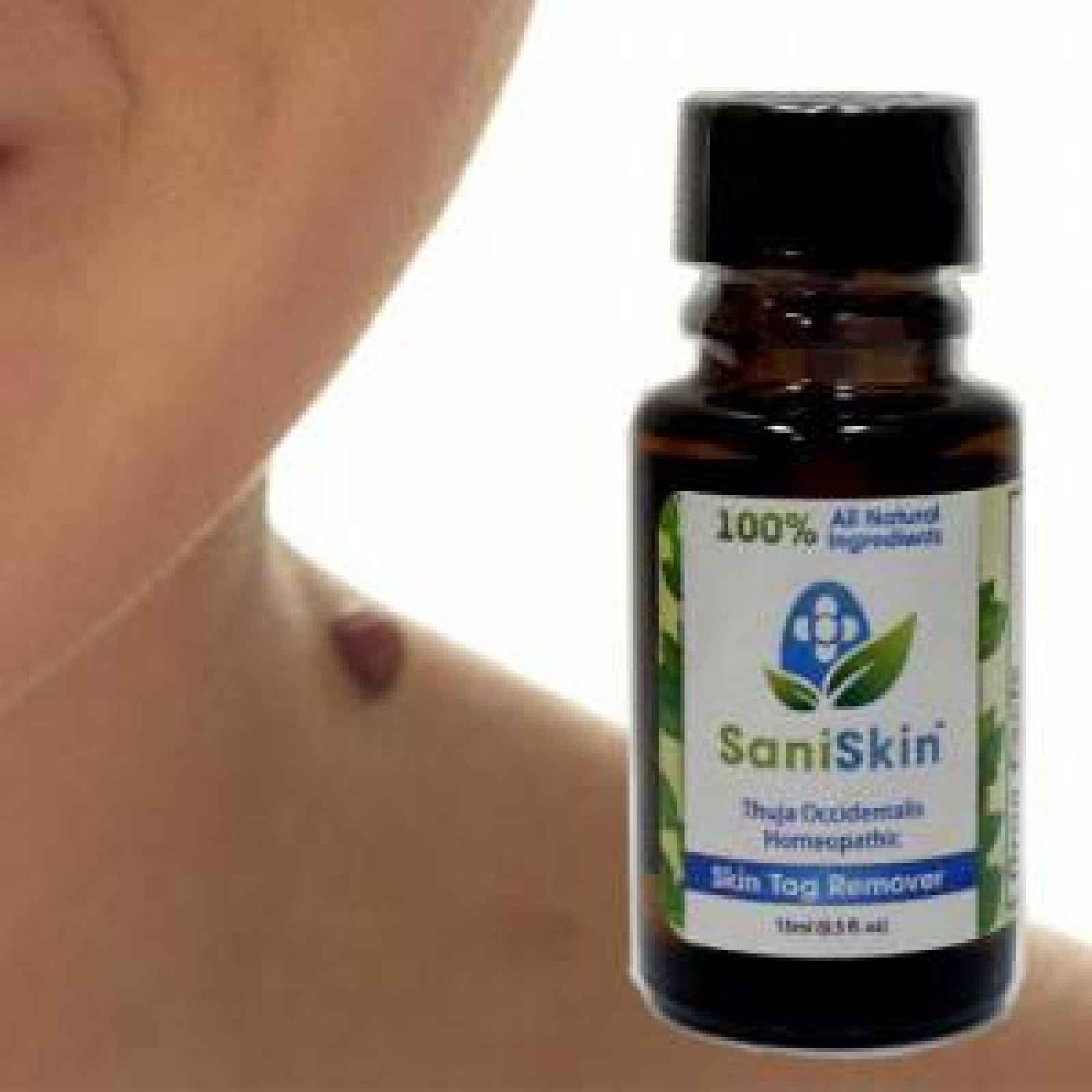 Sani Skin за папиломи и брадавици Топ Цена