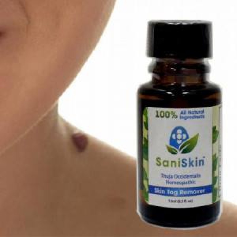 Sani Skin за папиломи и брадавици Топ Цена